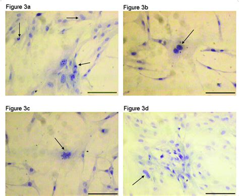 Pap Test Results Sample I Human At Mscs Papanicolaou Stain P2 100×