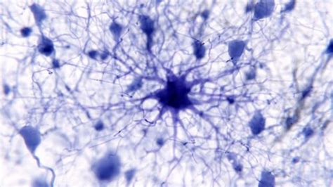 Episodic Memory Definition And Examples Live Science