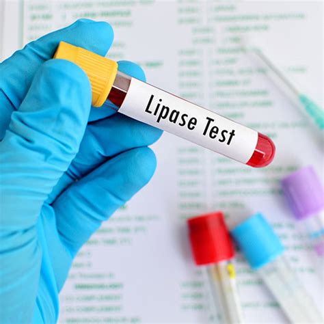 Tampa Lipase Test Labs