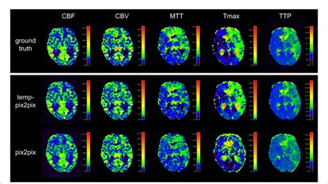 Figure Synthesized Perfusion Parameter Maps Middle Bottom Rows Download Scientific Diagram