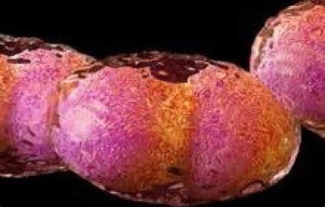 Smallpox In Ancient Egypt Deadly Virus Dates Back Nearly 4000 Years