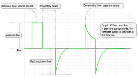 Interpreting The Shape Of The Ventilator Flow Waveform Deranged Physiology Interpreting The Shape Of The Ventilator Flow Waveform Deranged Physiology