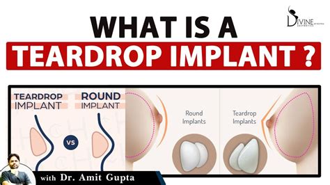 Teardrop Breast Implants Greenwood Sc Breast Augmentation Round Or