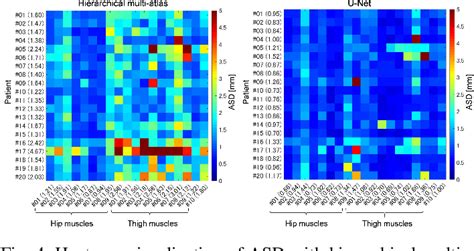 Automated Muscle Segmentation From Clinical Ct Using Bayesian U Net For Personalization Of A