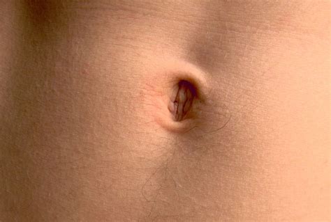 Born With No Belly Button