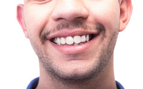 젊은 남자는 흰색 바탕에 깨끗 하 고 하얀 치아와 미소의 근접 보기 20 24세에 대한 스톡 사진 및 기타 이미지 20 24세 20 29세 건강관리와 의술 Istock