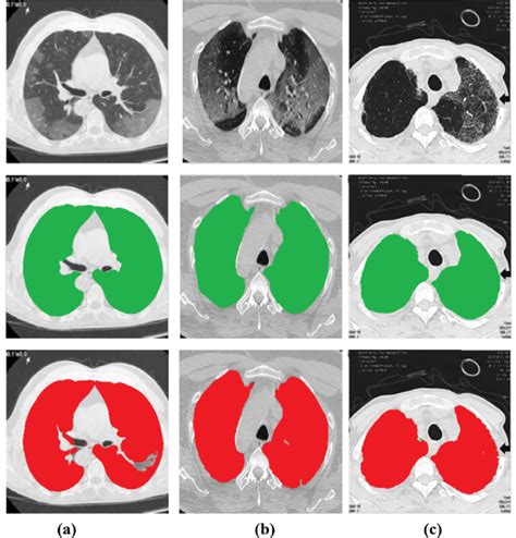 Visual Lung Segmentation Comparison A Axial Slice B Ground Truth Download Scientific