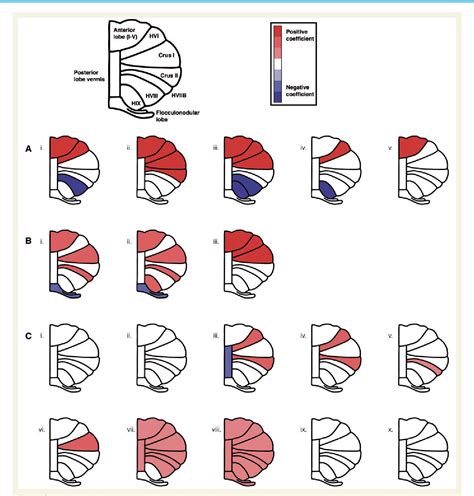 Figure 2 From Structural Cerebellar Correlates Of Cognitive And Motor Dysfunctions In Cerebellar