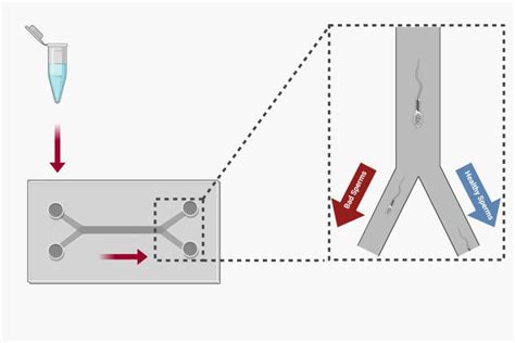 Microfluidics For Sperm Analysis And Selection UFluidix