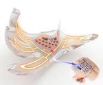 SNU Researchers Developed Electronic Skins That Wirelessly Activate