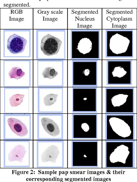 Figure 1 From Comparison Of Feature Selection Methods For Diagnosis Of Cervical Cancer Using Svm