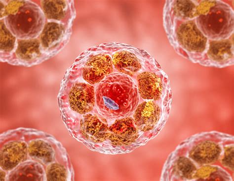 前列腺腺癌gleason分级 从3 4到5 5的预后差异 癌友网