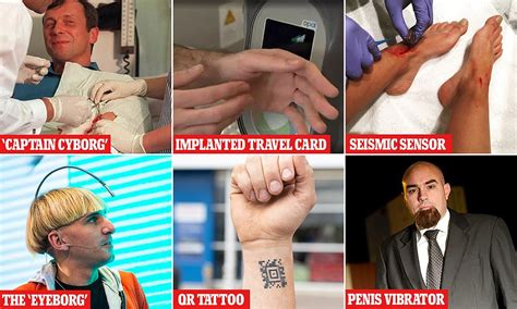 Most Bizarre Biohacks Including Man With An Implant To Make His Penis