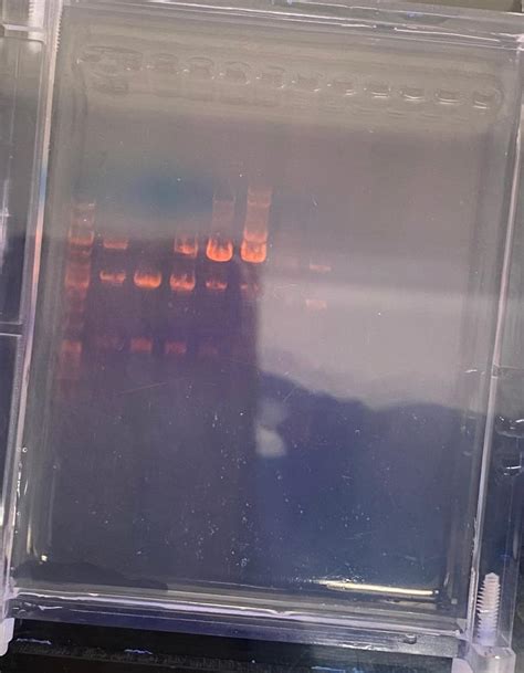 Explain The Principles Of Restriction Enzyme Chegg Com