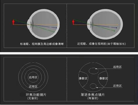 环焦镜片的原理和作用 环焦镜片的优点功能上篇