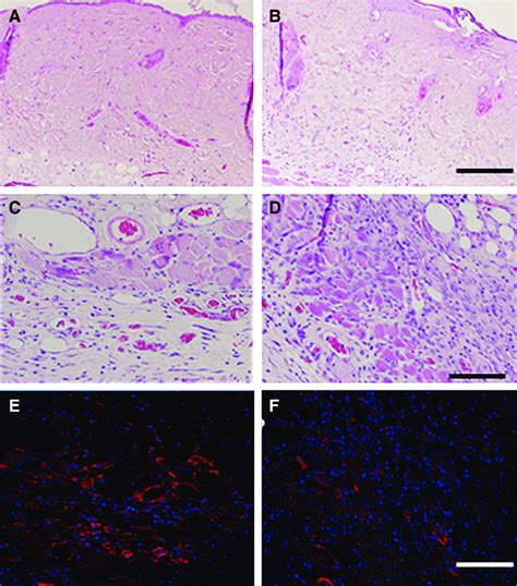 Histology And Immunohistochemistry Hande Staining Patterns Of Day 1 A Download Scientific