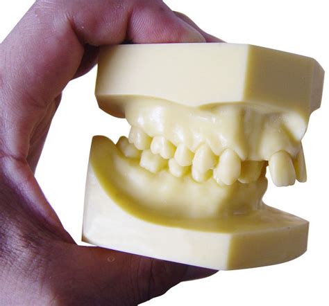 Light Yellow Different Occlusion Classification Dental Malocclusion Jaw