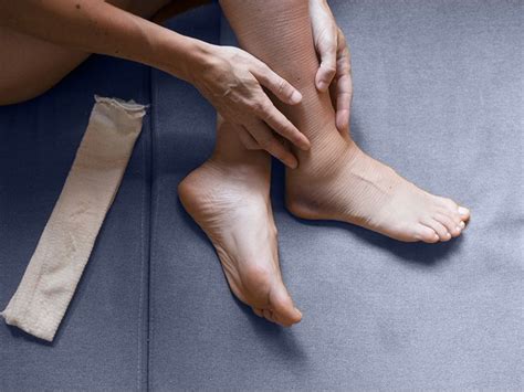 Necrotizing Cellulitis Vs Fasciitis Symptoms Treatment And More