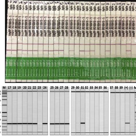 Comparison Of Reverse Transcription Recombinase Polymerase