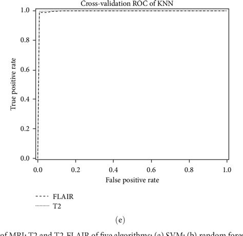 Figure 1 From High Performance Method For Brain Tumor Feature Extraction In Mri Using Complex