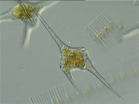 Phylum Dinoflagellata