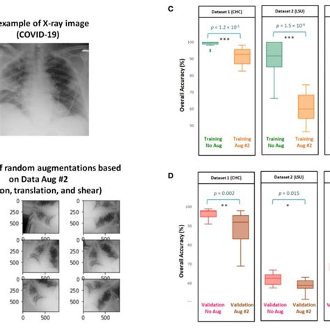 Efficacy Of Data Augmentation 2 22 On X Ray Images With And Without
