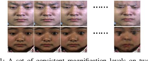 Figure 1 From A Novel Magnification Robust Network With Sparse Self