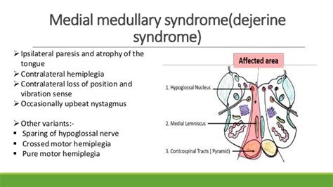 Lateral Medullary Syndrome Anatomy Figure 14 1 Vascular Lesions Of