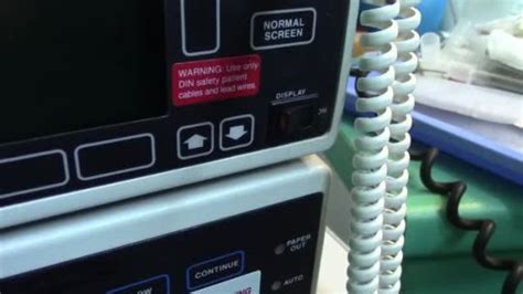 One Of My All Time Favorites—happy To Trade If You Tumbex