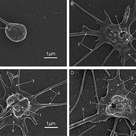 Sem Analysis Of External Platelet Interaction External Morphology Of