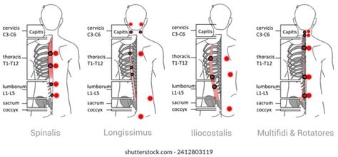 Trigger Point Memes 1 Thousand Trigger Points Back Royalty Free