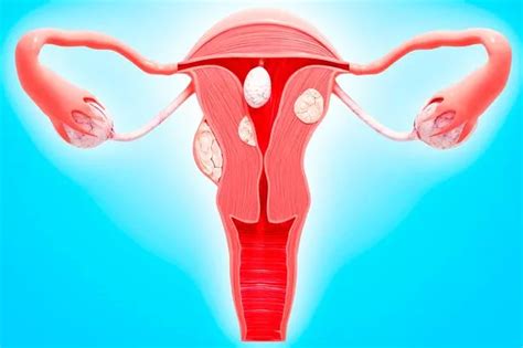 Subtle Lung Cancer Symptom Spotted On Your Fingers Unexpected Sign