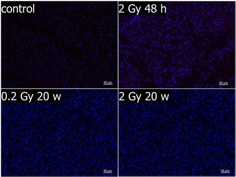 Analysis Of Apoptotic Cells By The Tunel Staining Blue Nuclei Red Download High Quality