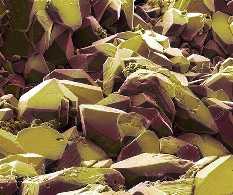 Bladder Stone Sem Stock Image M1950149 Science Photo Library