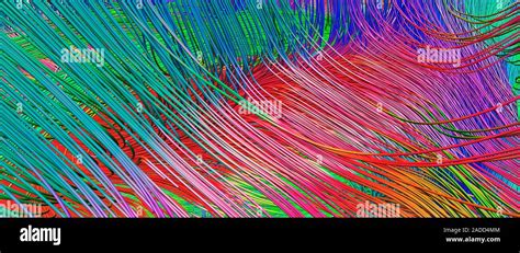 Diffusion Tensor Imaging Dti Scan Reconstructed Brain White Matter