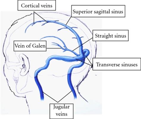 The Major Venous Sinuses And Their Tributaries Open I