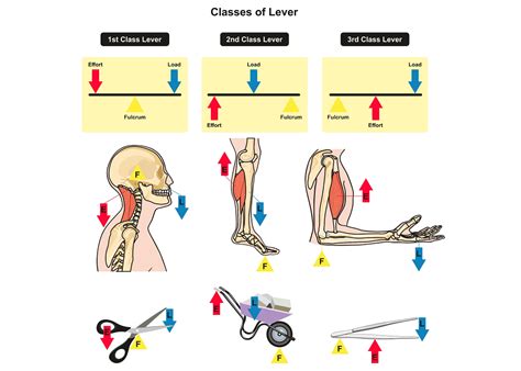 Lever Arm Human