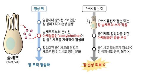 Medigate News 카이스트 염증성 장질환 진단·회복 핵심효소 발견