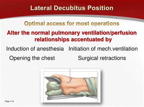 Ppt Monitoring During Thoracic Anesthesia Powerpoint Presentation