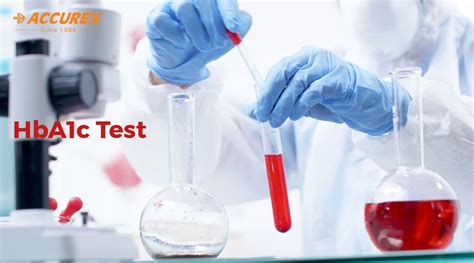 Lab Test Hemoglobin A C Hba C Discount Wholesalers