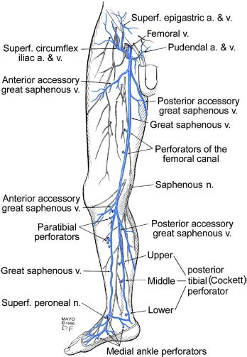 The Hemodynamics And Diagnosis Of Venous Disease Journal Of Vascular