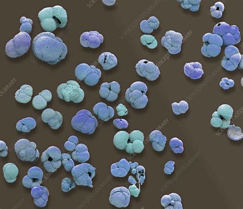 Foraminifera Sem Stock Image F043 8701 Science Photo Library