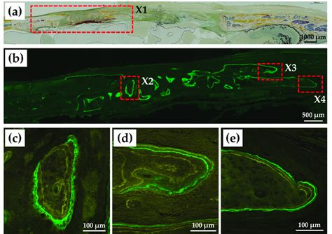 A Villanueva Stained Image Of A Rat Cranial Bone Defect 8 Weeks After