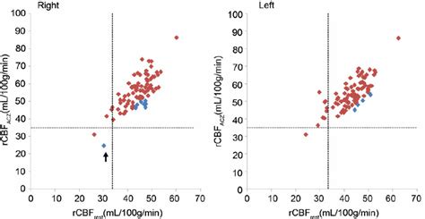 Resting Rcbf And Rcbf After Intravenous Acetazolamide Infusion In The