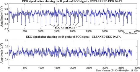 A Sample Of Cleaned And Uncleaned Eeg Signal Download Scientific Diagram