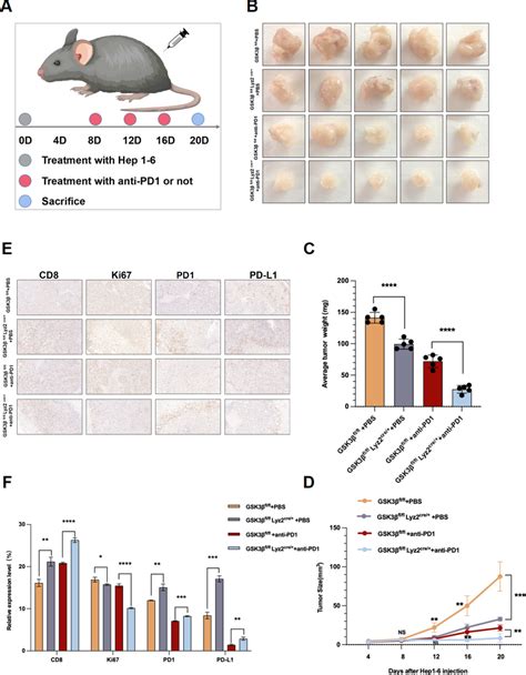 The Sensitivity Of Anti Pd1 Immunotherapy In Hcc Was Increased In Gsk3β