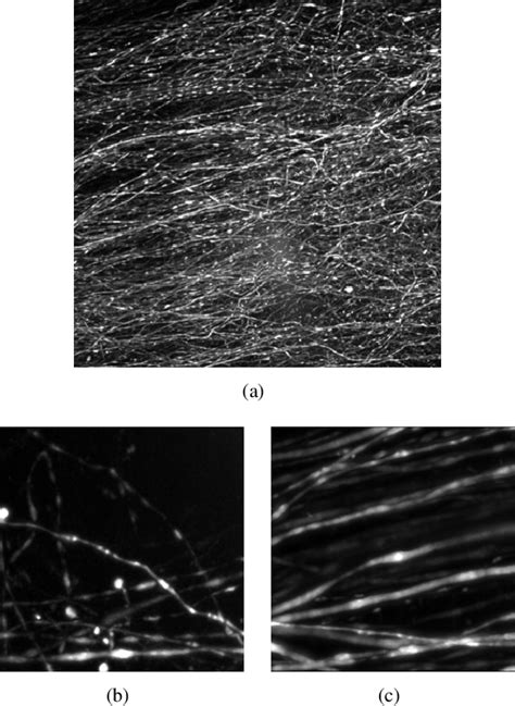 figure 1 from axon tracing and centerline detection using topologically