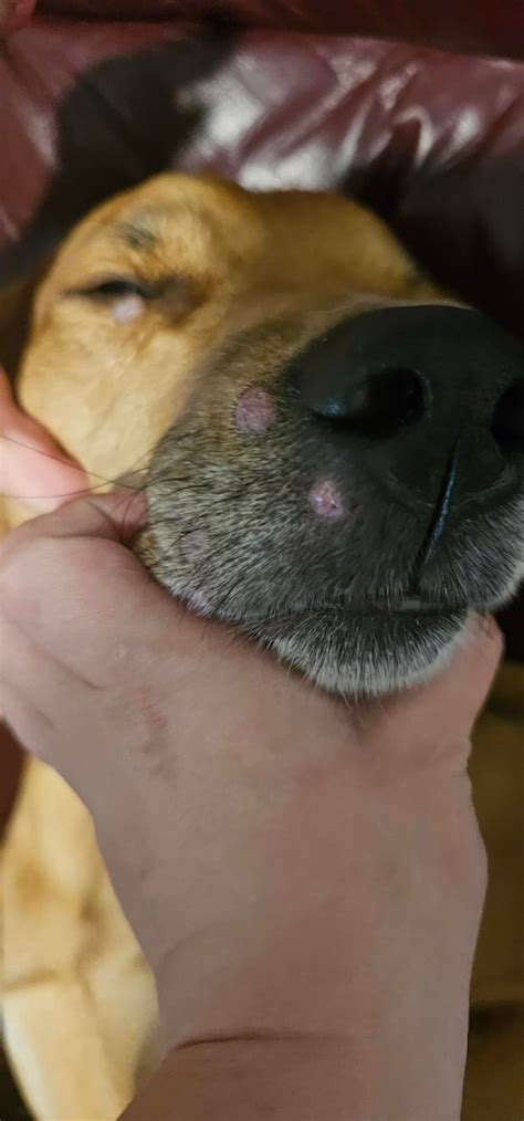 Bug Bites Ringworm Help R Bugbites