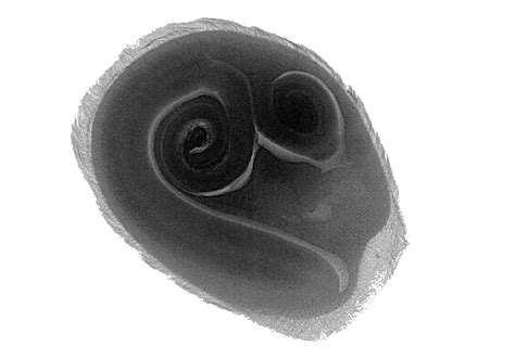 ADVACAM Detectors Application In Biomedicine