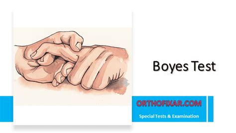 Balance Tests And Assessment Dynamic And Static Orthofixar 2025